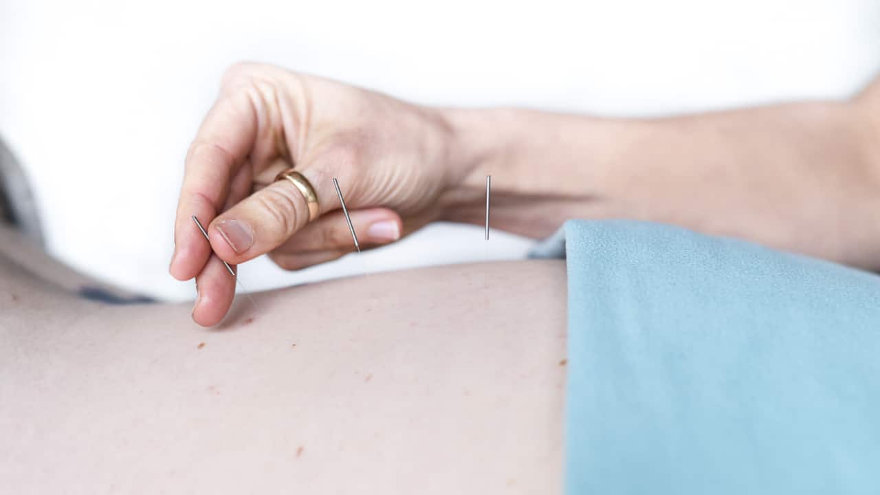 Acupuncture for Health - Clear Pathways Acupuncture & Wellness